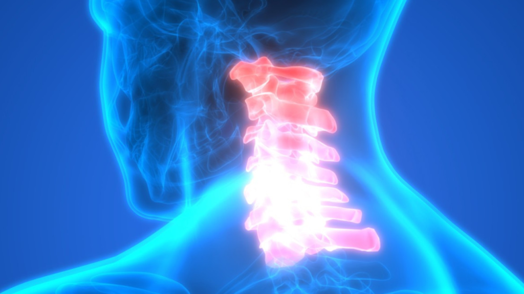 Legamento alare rotula: comprendere e trattare questo raro disturbo del ...